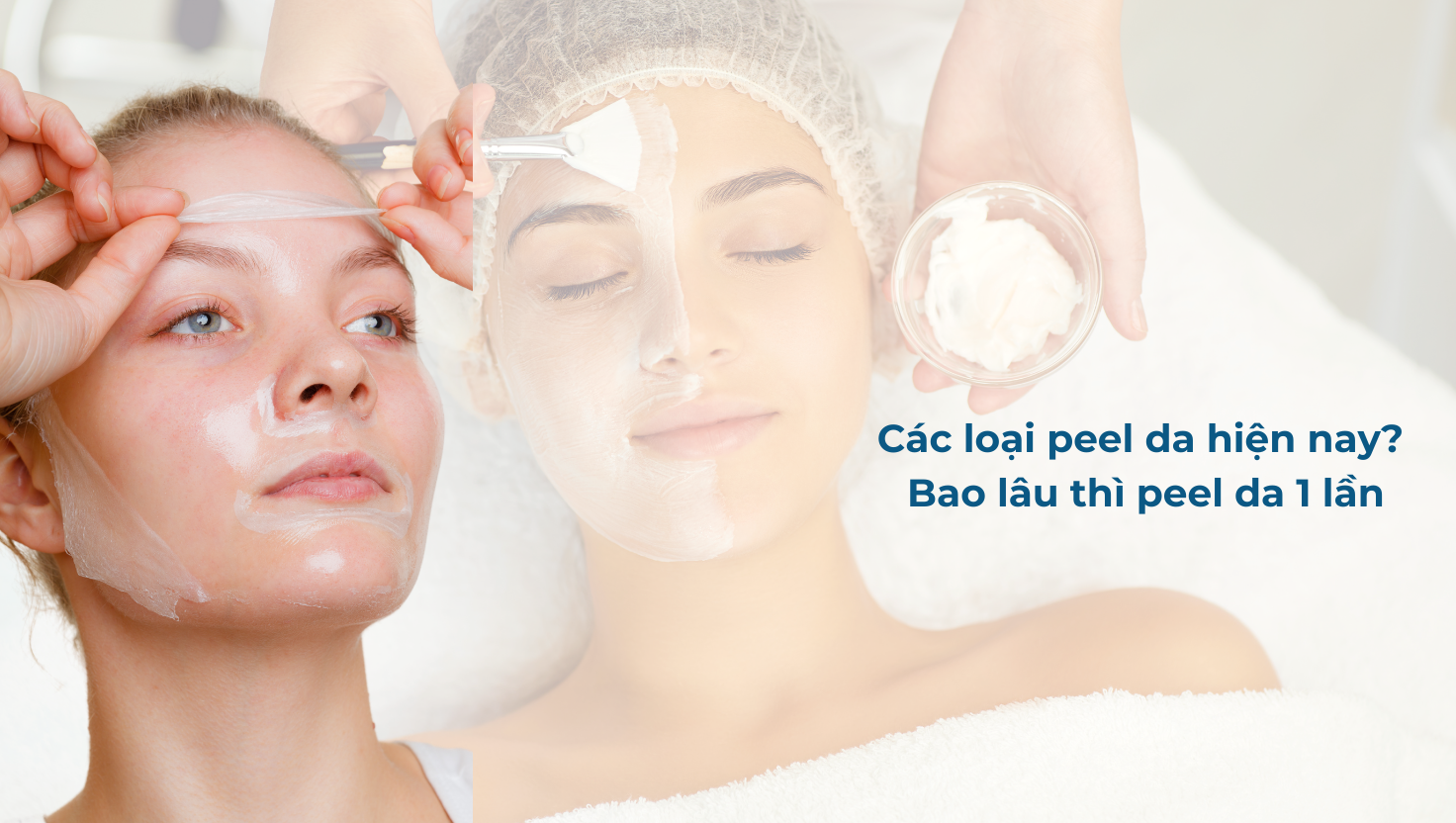 Các loại peel da hiện nay? Bao lâu thì peel da 1 lần - Ed Beauty ...